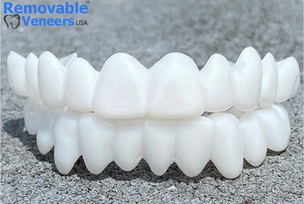 Removable Veneers Review | Best Teeth And Even Better Smiles For 2022